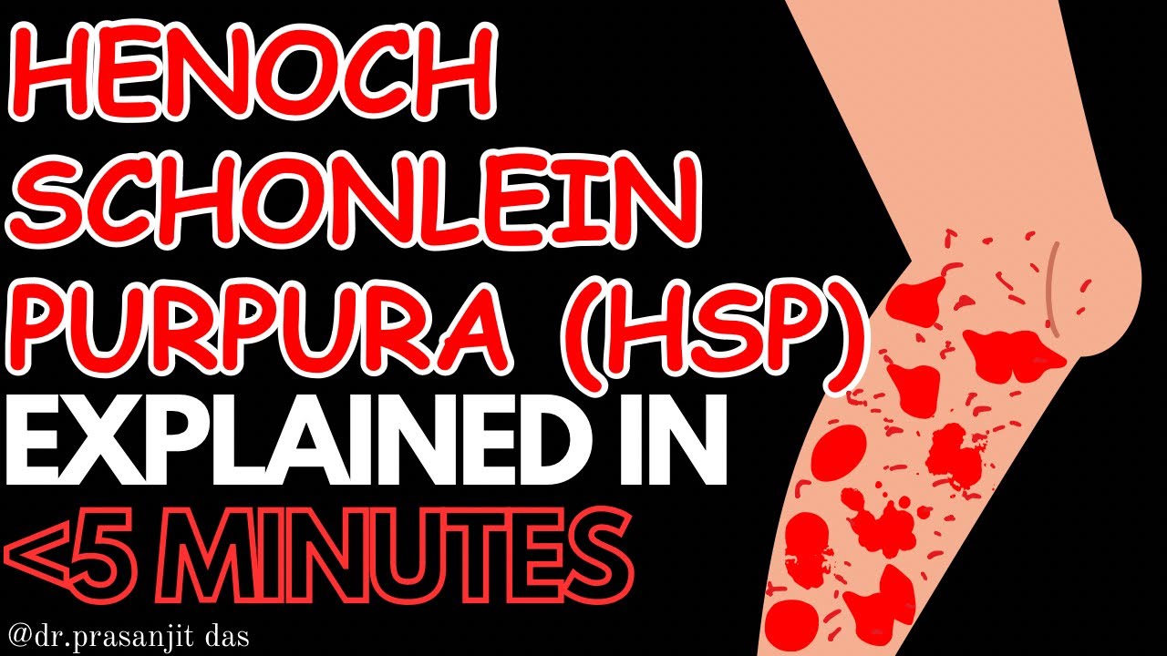 HENOCH-SCHONLEIN PURPURA (HSP) EXPLAINED IN LESS THAN 5 MINUTES- BY ...