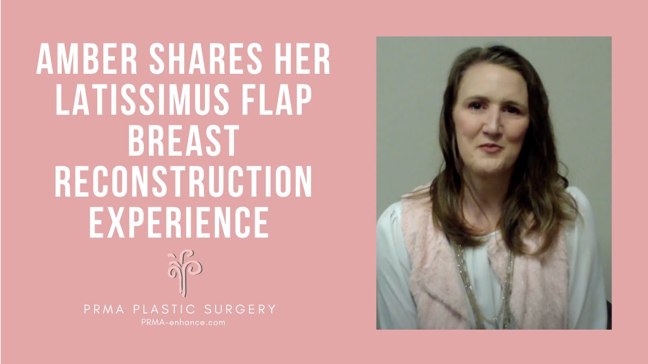 Latissimus Flap Breast Reconstruction | Amber's Experience - YouTube