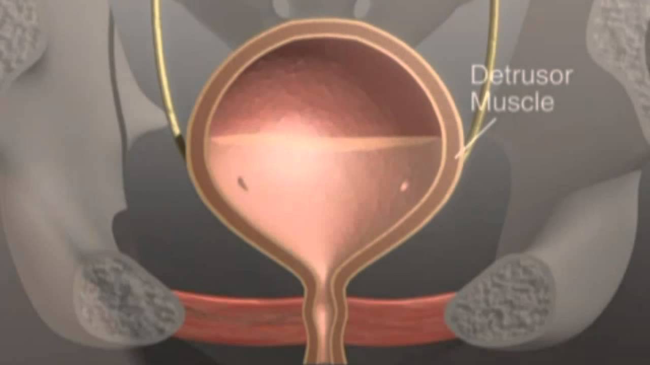 Bladder Health What Is Overactive Bladder YouTube