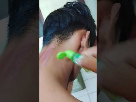 KEROKAN LEHER REMAJA (4)