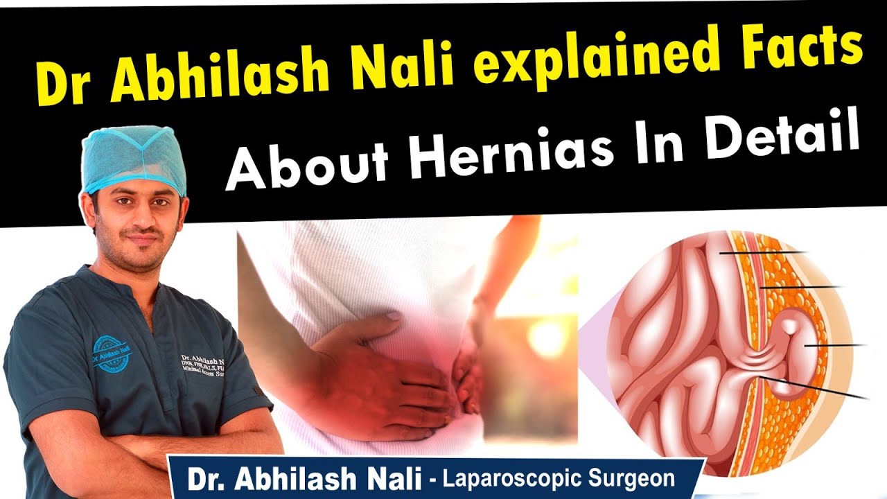 Health Facts About Hernias || Hernia: What it is, Types, Causes and ...
