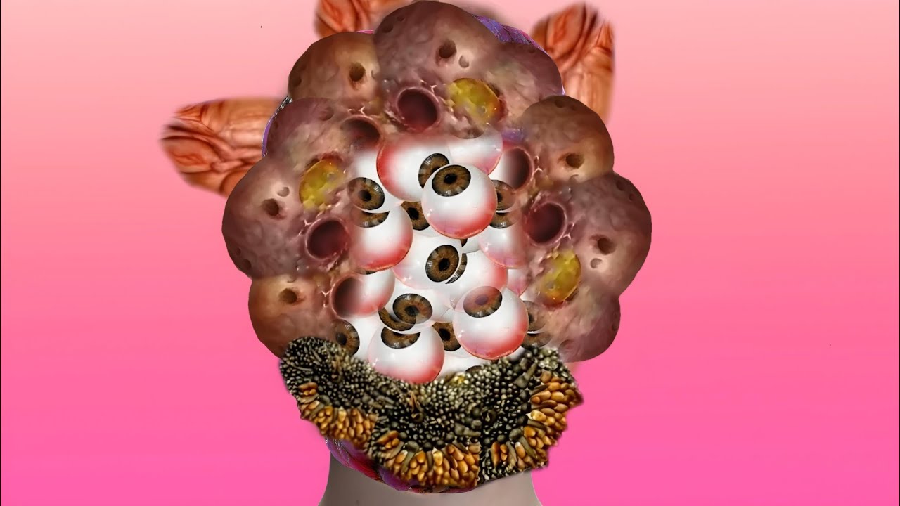 ASMR stop motion, treat | trypophobia nature treatments Back Side ...