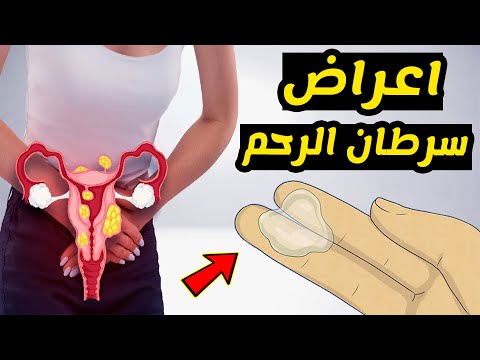 اعراض سرطان الرحم