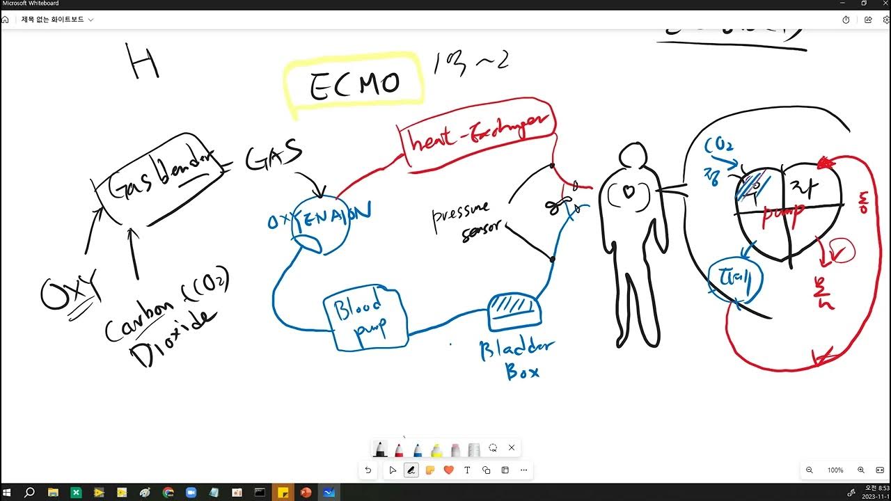 ECMO : 체외막산소공급기 - YouTube