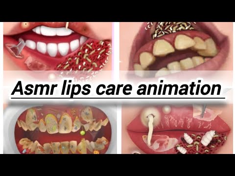 Asmr remove big acne, maggots infection and dry mouth , lip care ...