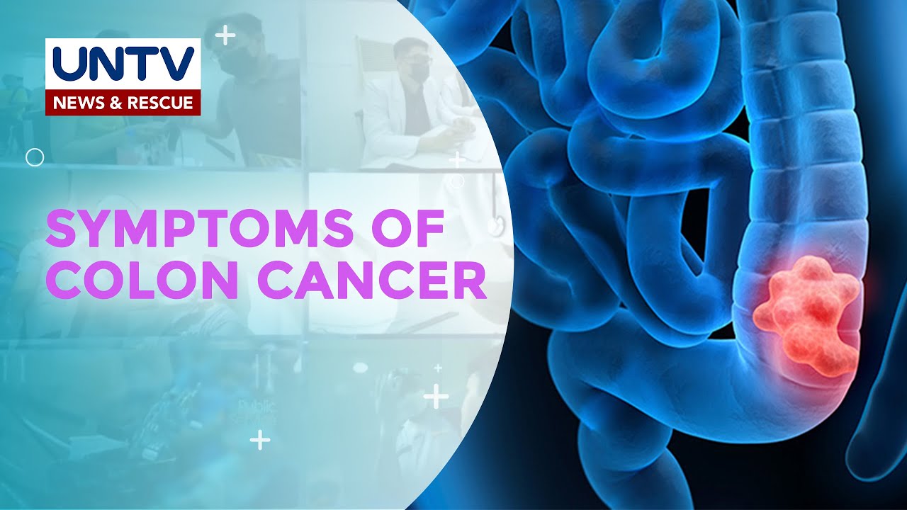 Ano ang mga senyales o simtomas ng isang taong may colon cancer? - YouTube