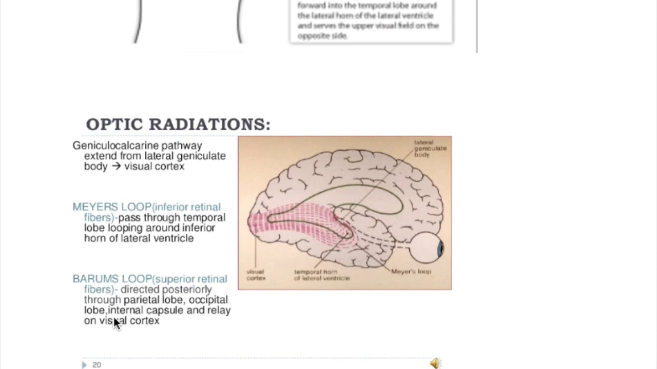 Optic nerve lesions, Bitemporal hemianopia heteronymous hemianopia ...