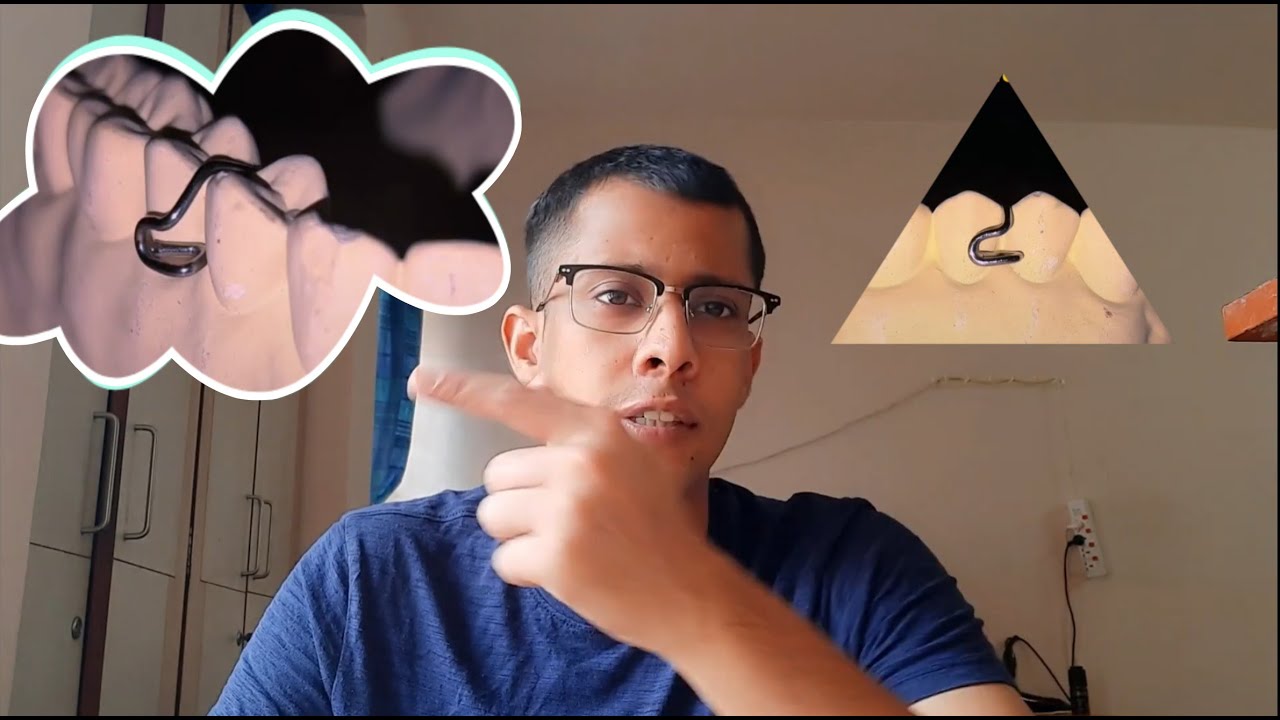 how to make triangular clasp || c clasp || ortho wire bending - YouTube