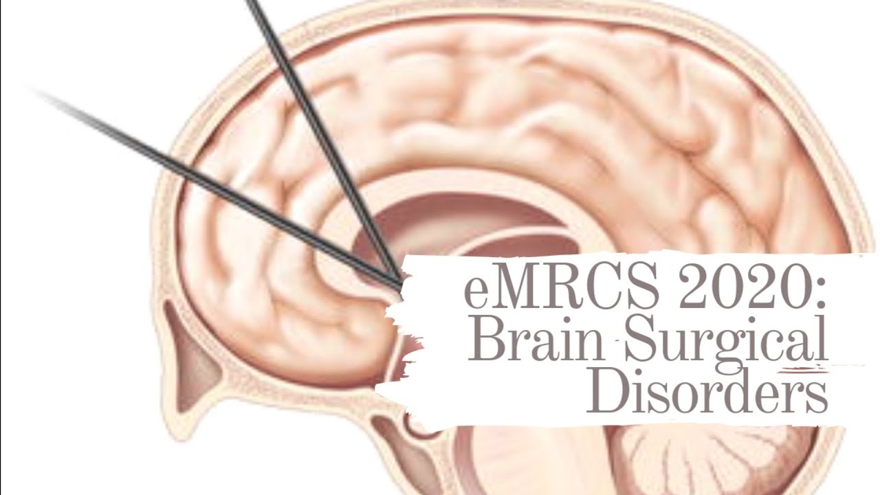 eMRCS 2020: Brain Surgical Disorders - YouTube
