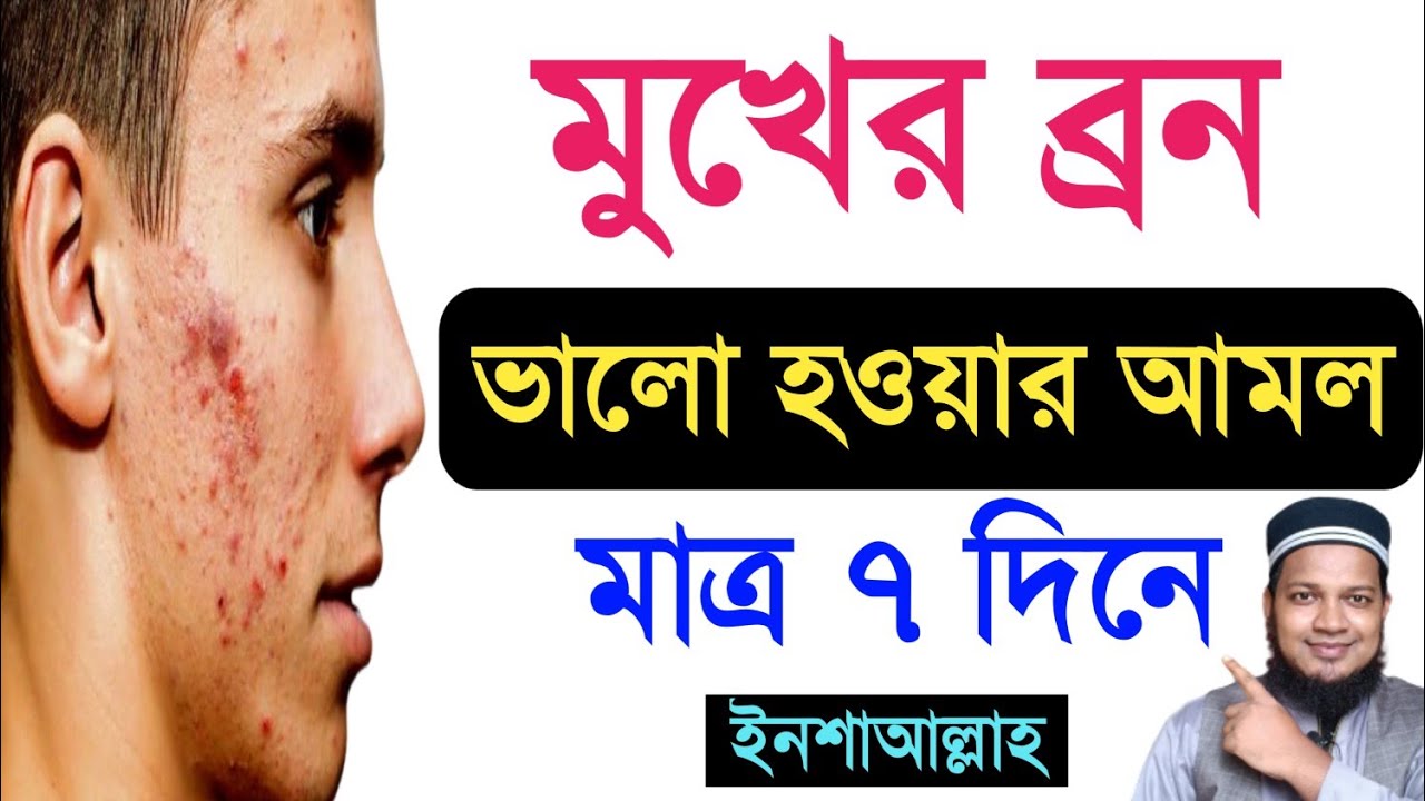 মুখের ব্রণ ভালো হওয়ার আমল দোয়া mukher bron valo hower amol doah ...