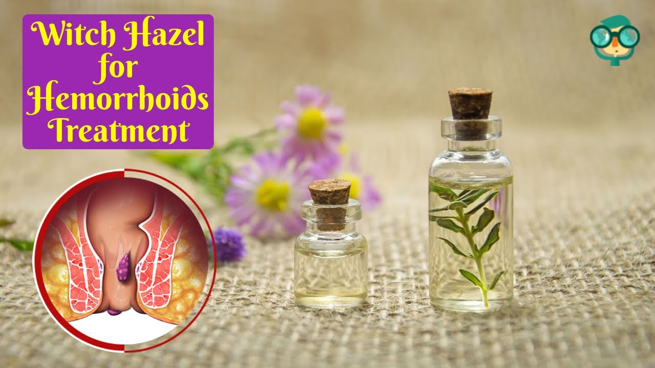 How to Use Witch Hazel for Hemorrhoids Treatment? Witch Hazel Benefits ...