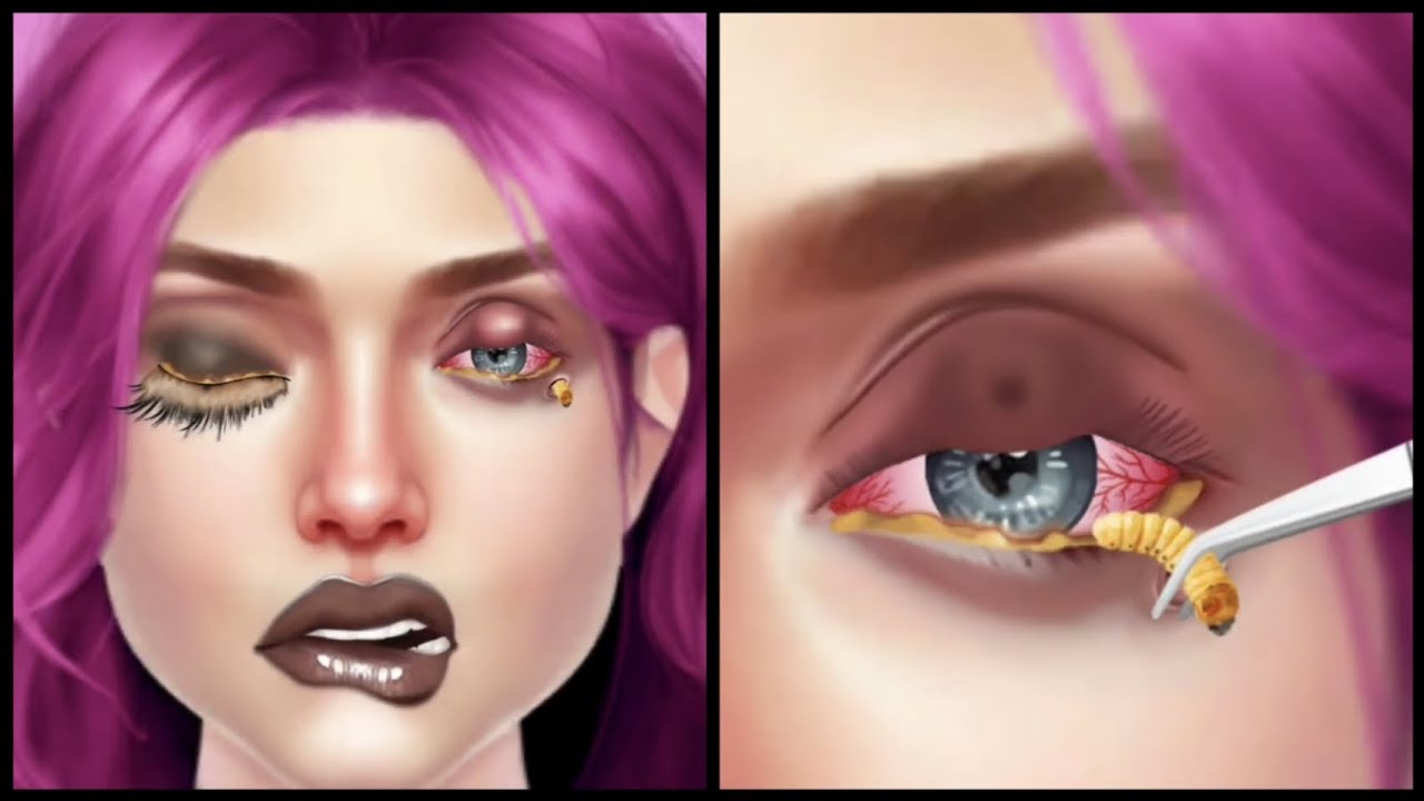 ASMR Deep Eyes Cleaning | So Satisfying - YouTube