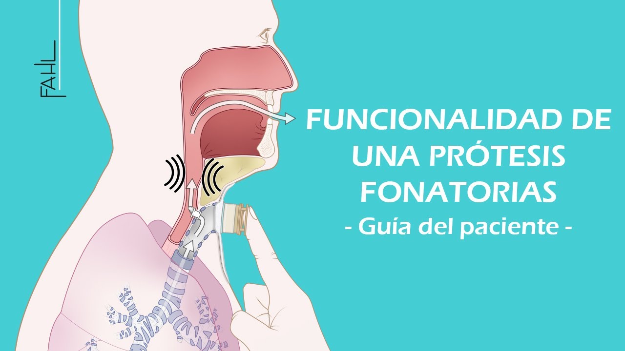 Funcionalidad de una prótesis fonatorias | Animación | Fahl ...