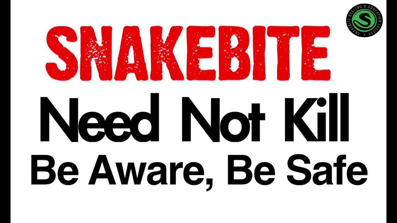 Snakebite - Be Informed, Be Safe (ENGLISH) - YouTube