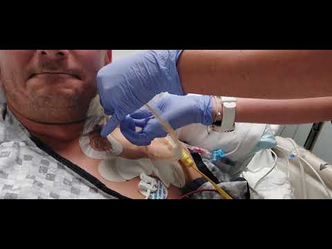 Swan catheter removal - YouTube