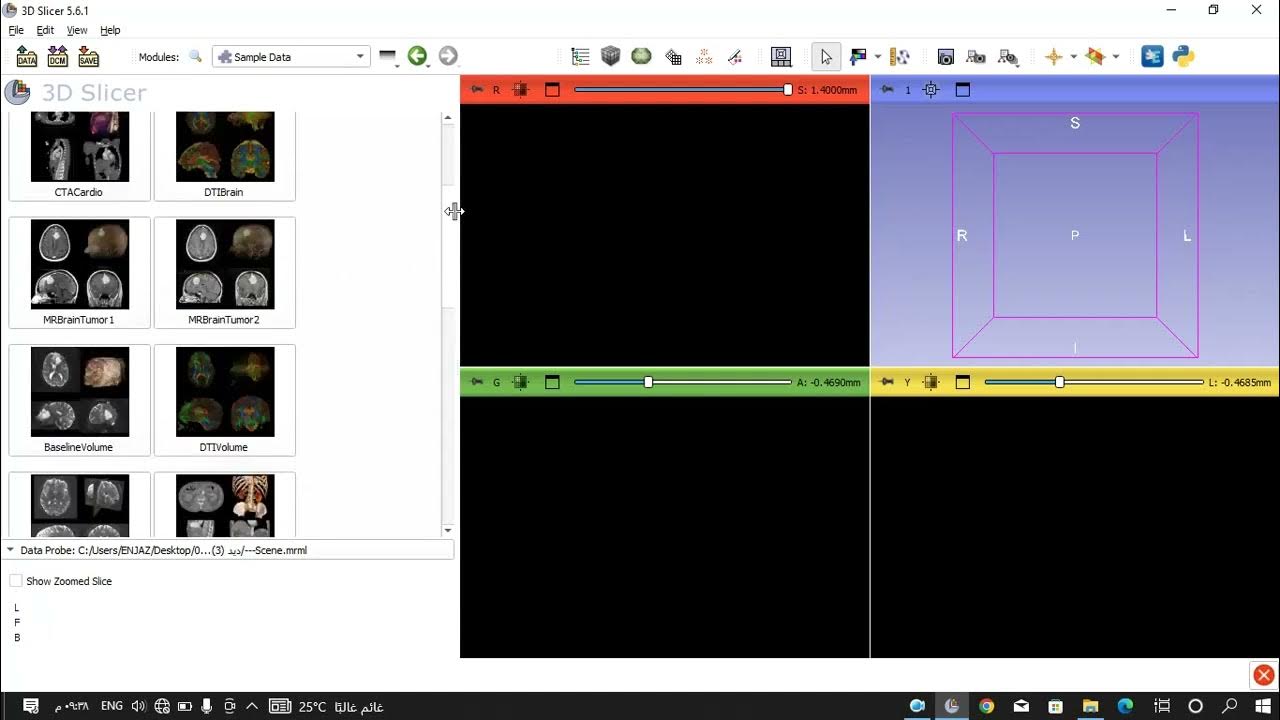 Import DICOM files into 3D Slicer - YouTube