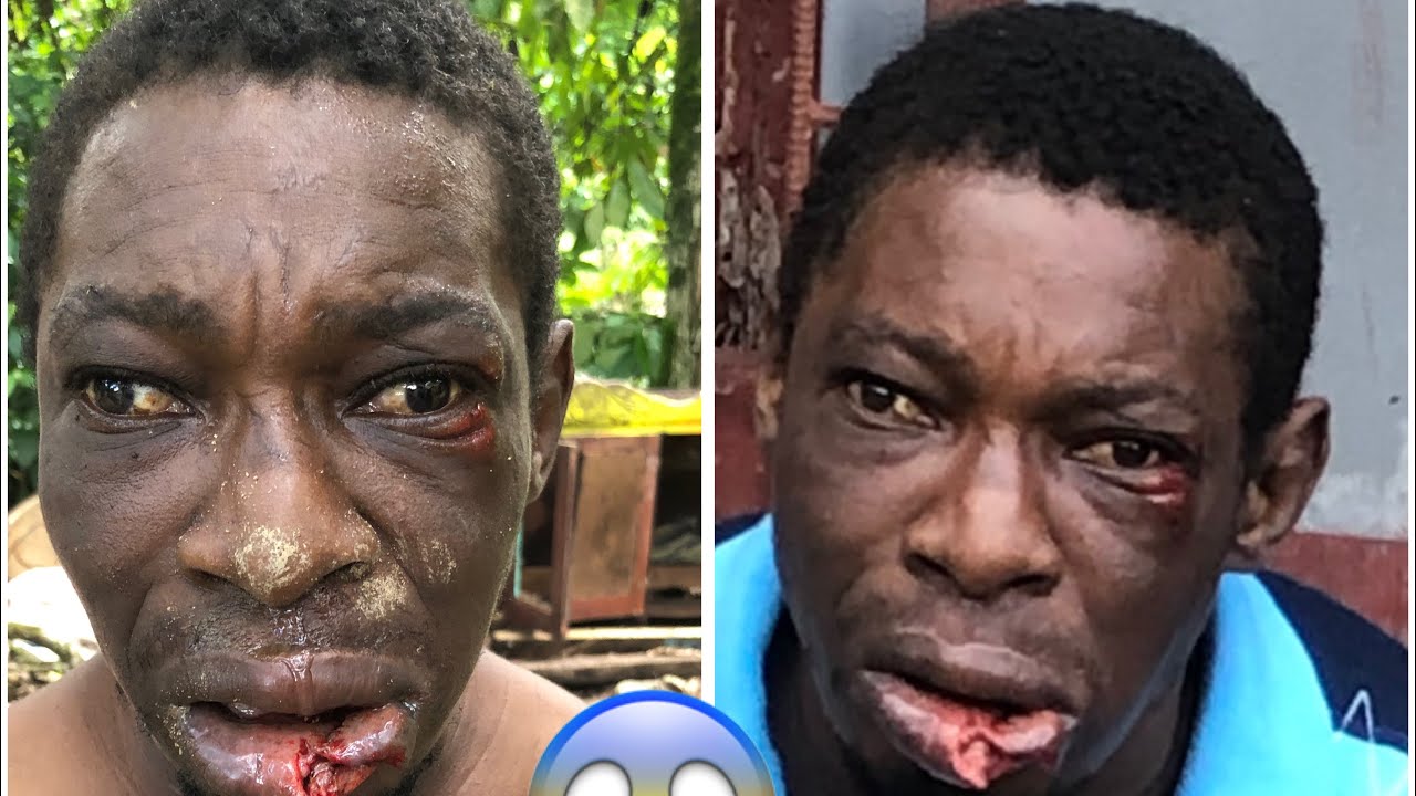 LESS FORTUNATE people Always suffer 😭😭😭🙏🙏🙏🥹☹️☹️☹️🇯🇲 - YouTube