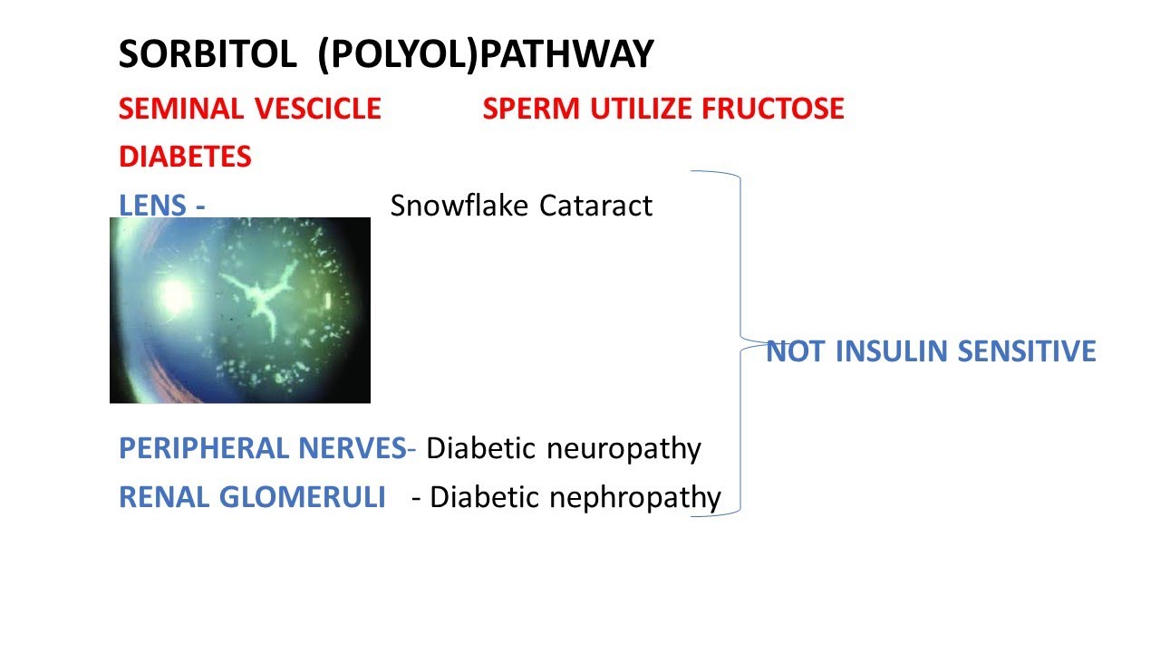 sorbitol pathway polyol pathway and diabetes - YouTube