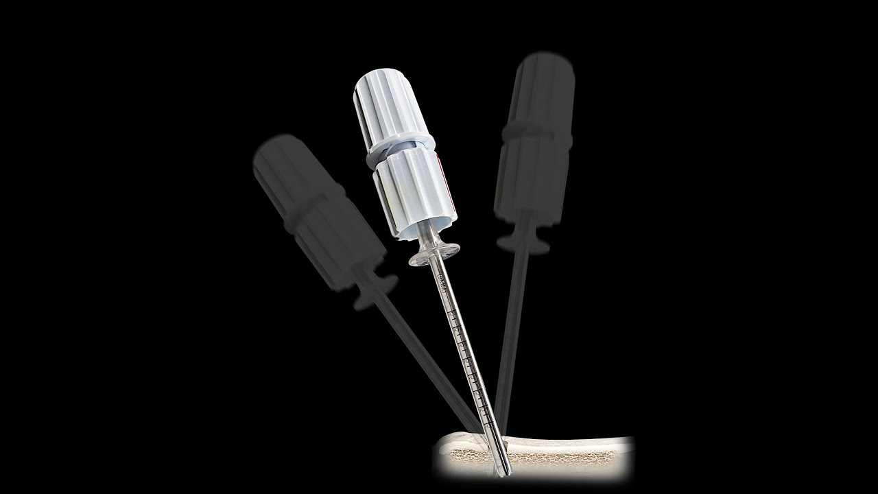 COREX™ Bone Harvester - YouTube