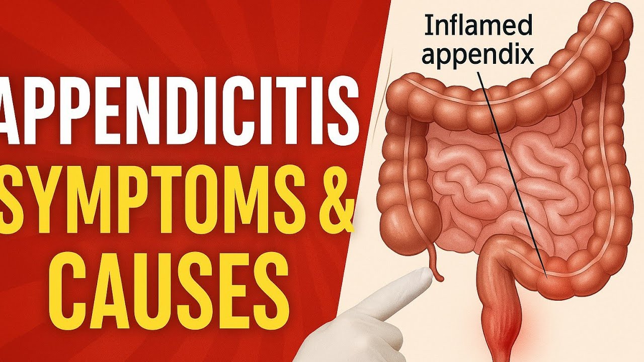 Appendicitis: Warning Signs You Should NEVER Ignore! 🚨 - YouTube