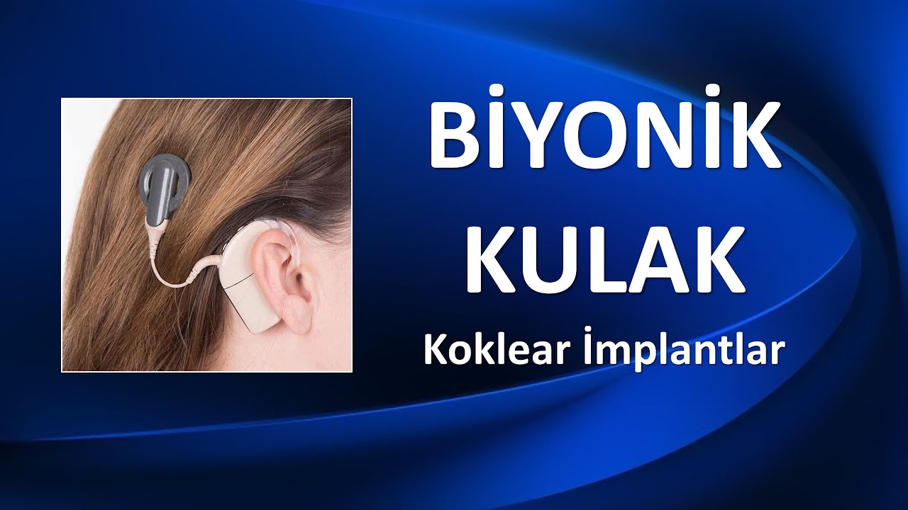 BİYONİK KULAK: KOKLEAR İMPLANTLAR - YouTube