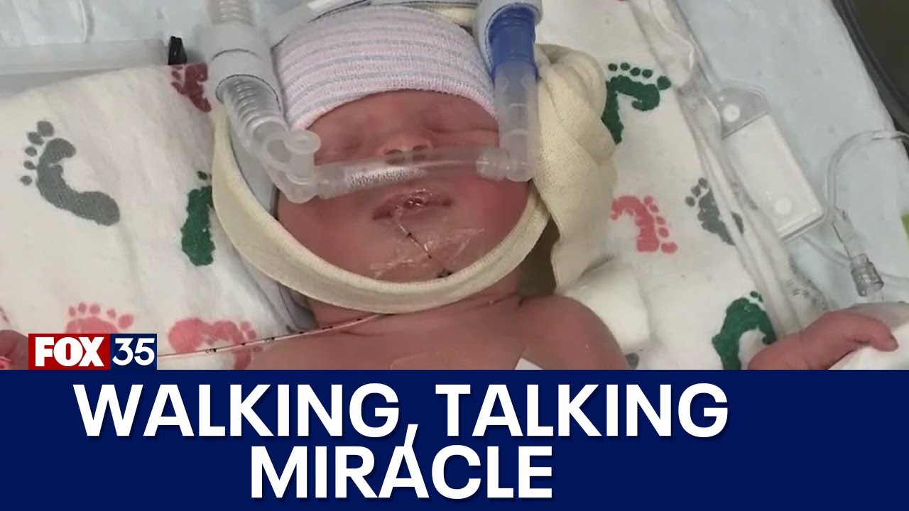 Baby born with part of its skull missing, exposing brain: 'A lot of scary moments" - YouTube