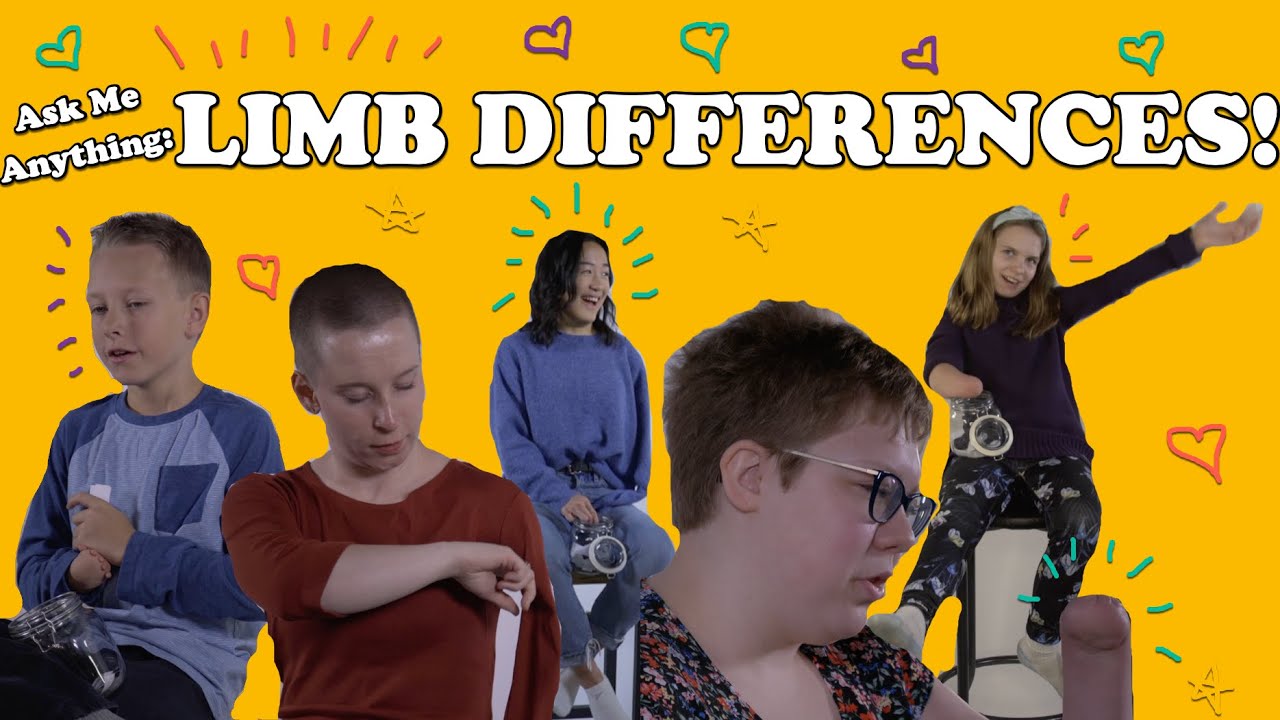 LIMB DIFFERENCES: ASK ME ANYTHING (featuring kids!) - YouTube