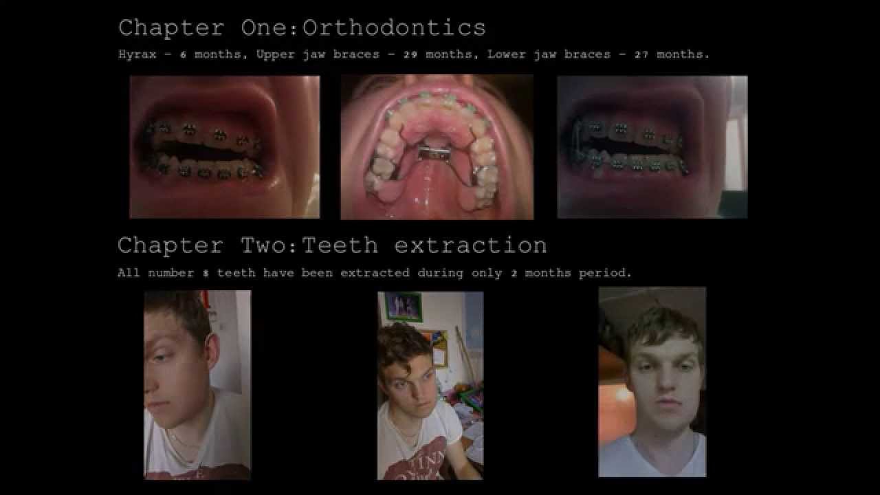 Progenism. Liberation. Whole story. - YouTube