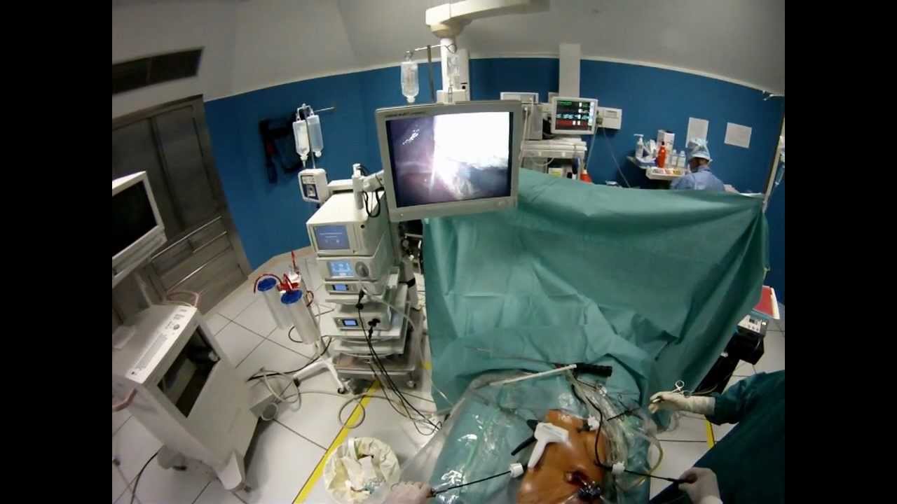 Vésicule coelio vue externe (Laparoscopic cholecystectomy: outer view ...