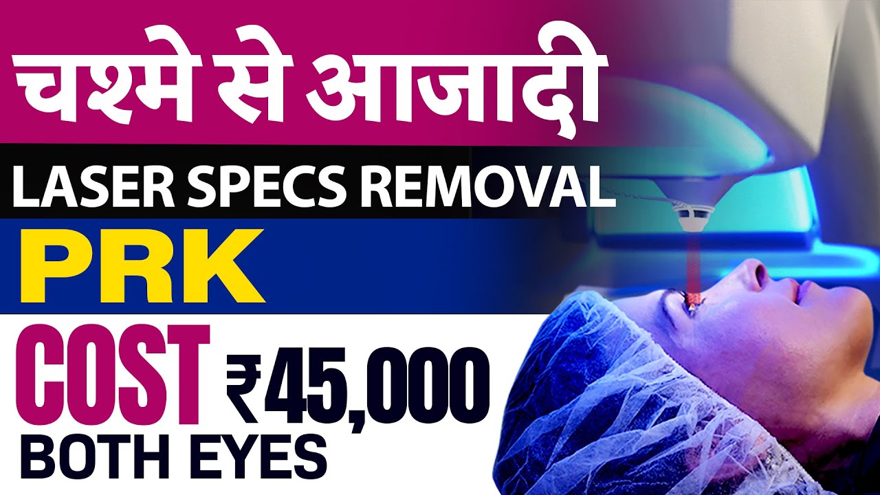 Cost & Process of PRK Laser for Specs Removal - YouTube