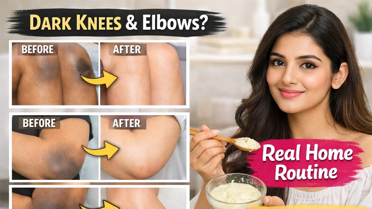 Knee & Elbow Whitening Routine at Home | Remove Darkness Naturally ...