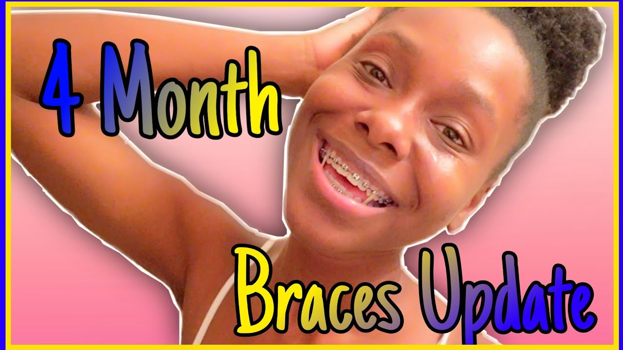 BRACES JOURNEY: FOUR MONTH BRACES UPDATE | NATURAL NASHEKA - YouTube