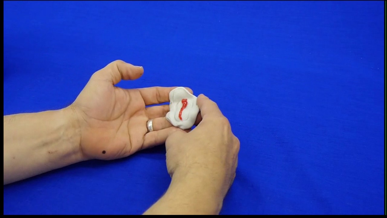 01 Understandable Occlusion - 14 Anterior Guide Tables - slide40 - YouTube