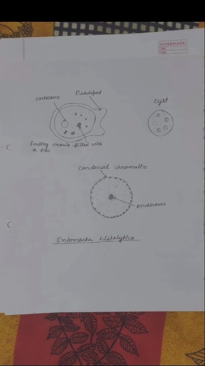 Study Of Parmanent Slide Of Entamoeba Histolytica 📚 M.Sc 1st Semester ...