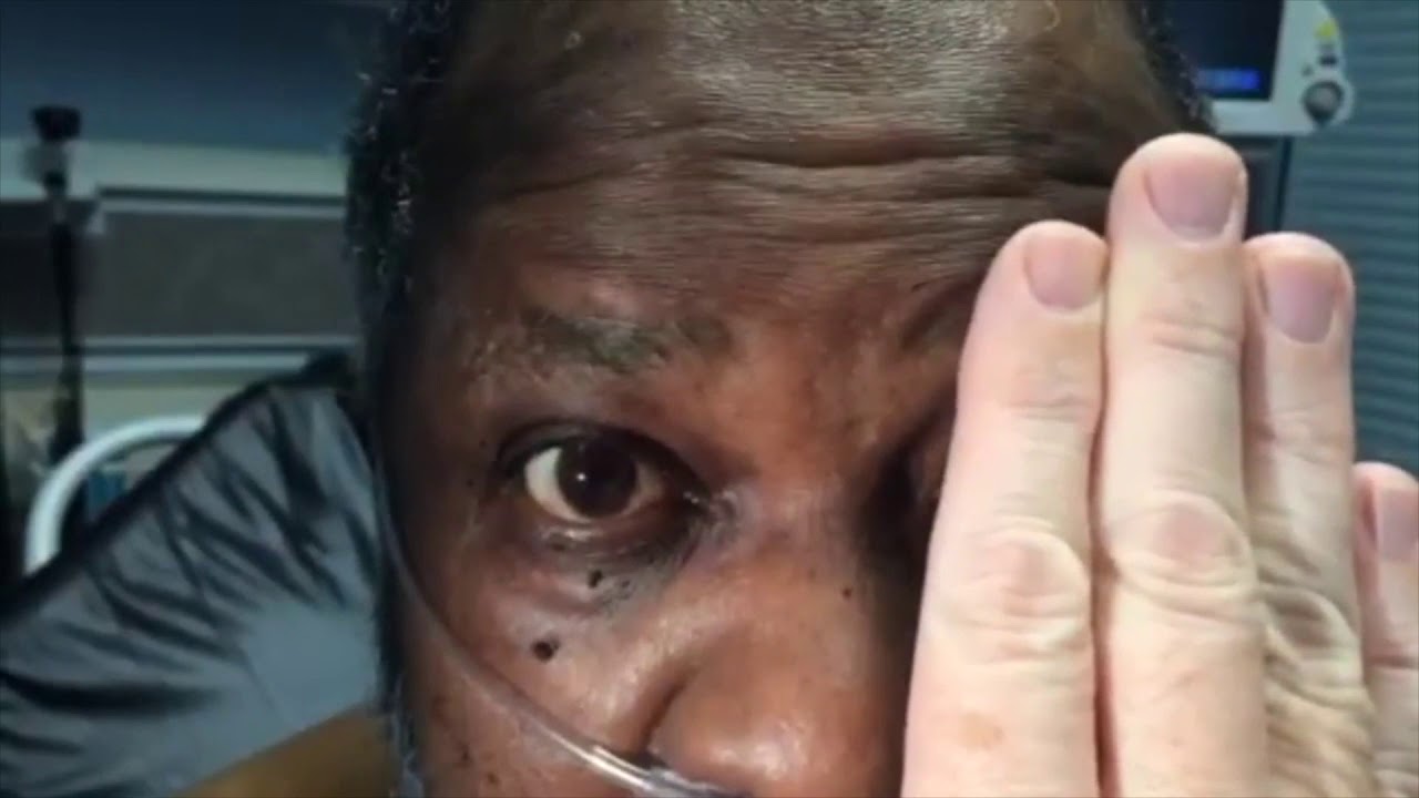 HINTS plus examination - YouTube