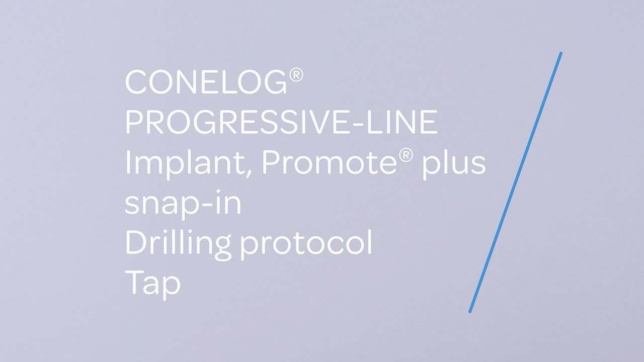 CONELOG PROGRESSIVE LINE Implantate | Promote plus gesteckt ...