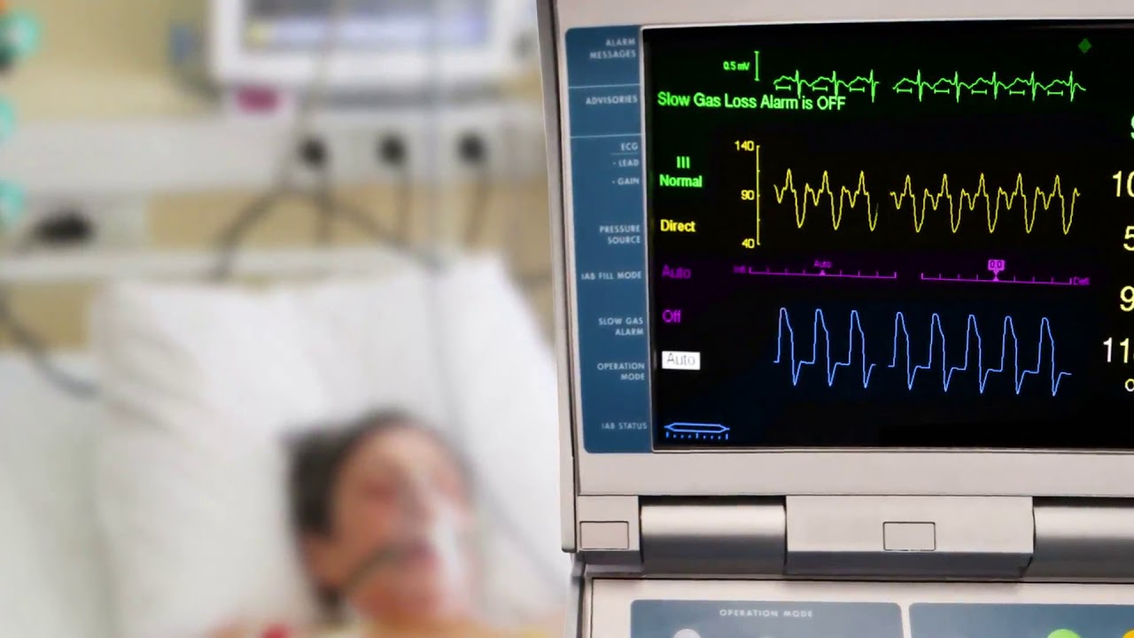 icu patient with ecg monitor and iabc ny9jd yh D - YouTube