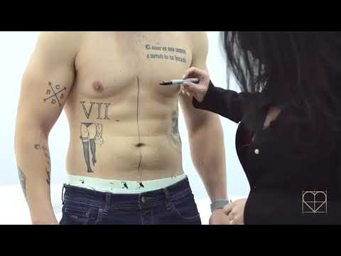 Marcación abdominal, lipo VASER en CLÍNICAS LOVE - YouTube