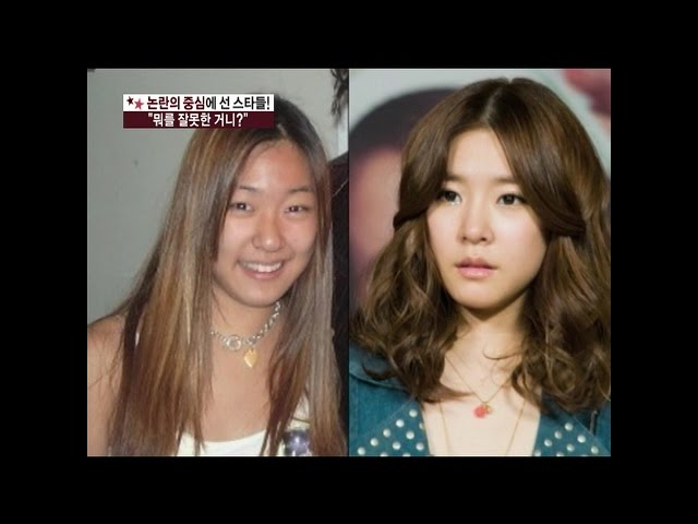 Snsd Taeyeon Plastic Surgery