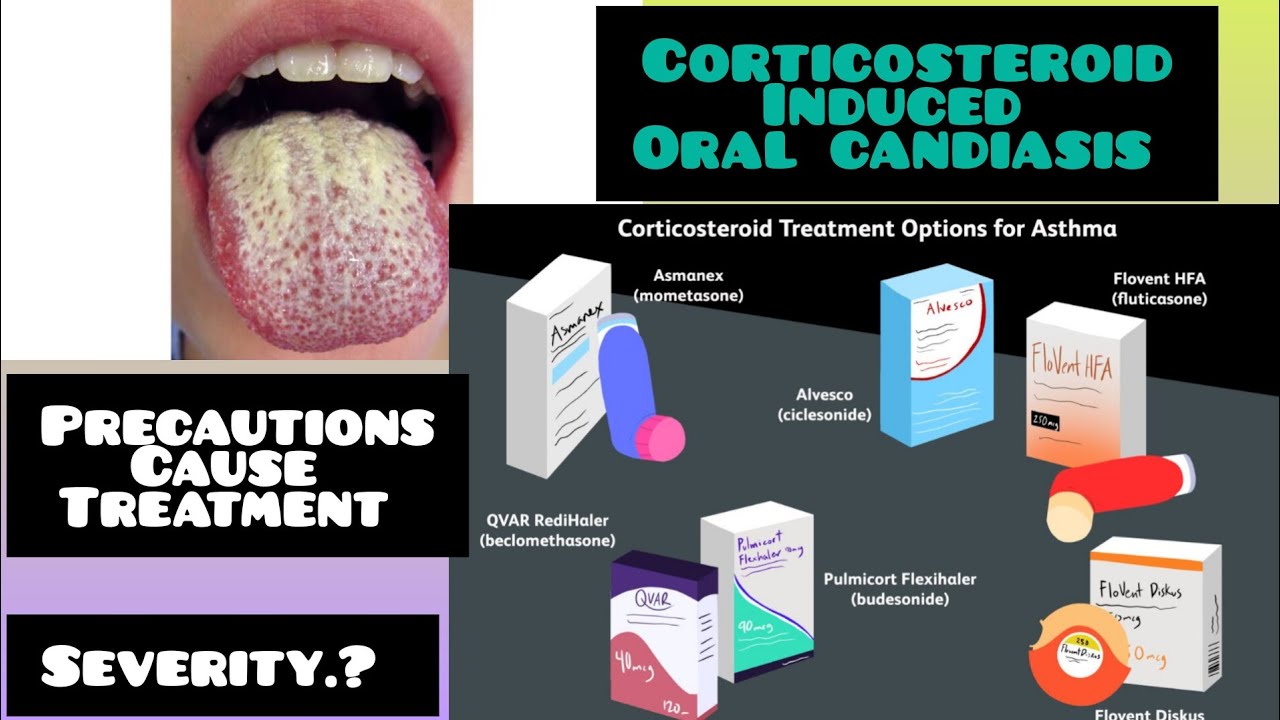 does you know inhaled corticosteroids induce oral candiasis #medical # ...