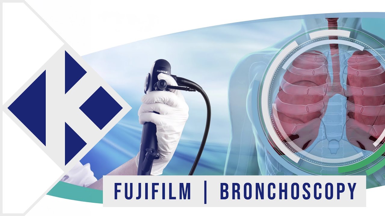 Fujifilm | Bronchoscopy - YouTube