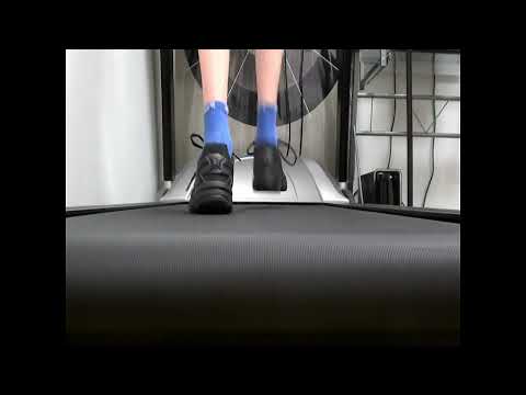 Does your child have flat feet?