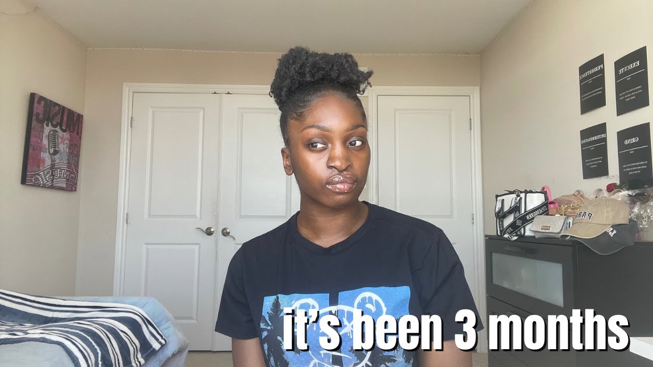 4 months after getting jaw surgery… - YouTube