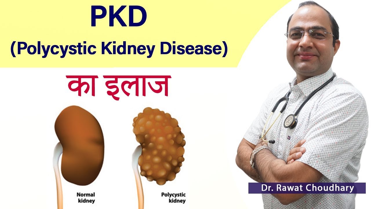 Polycystic Kidney Disease Treatment | पोल्य्सिस्टिक किडनी डिजीज | What ...