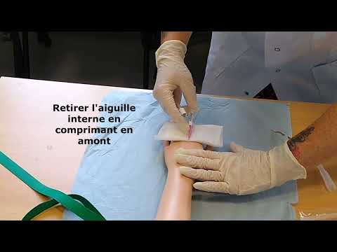 06 - Pose de cathéter veineux et de perfusion - YouTube