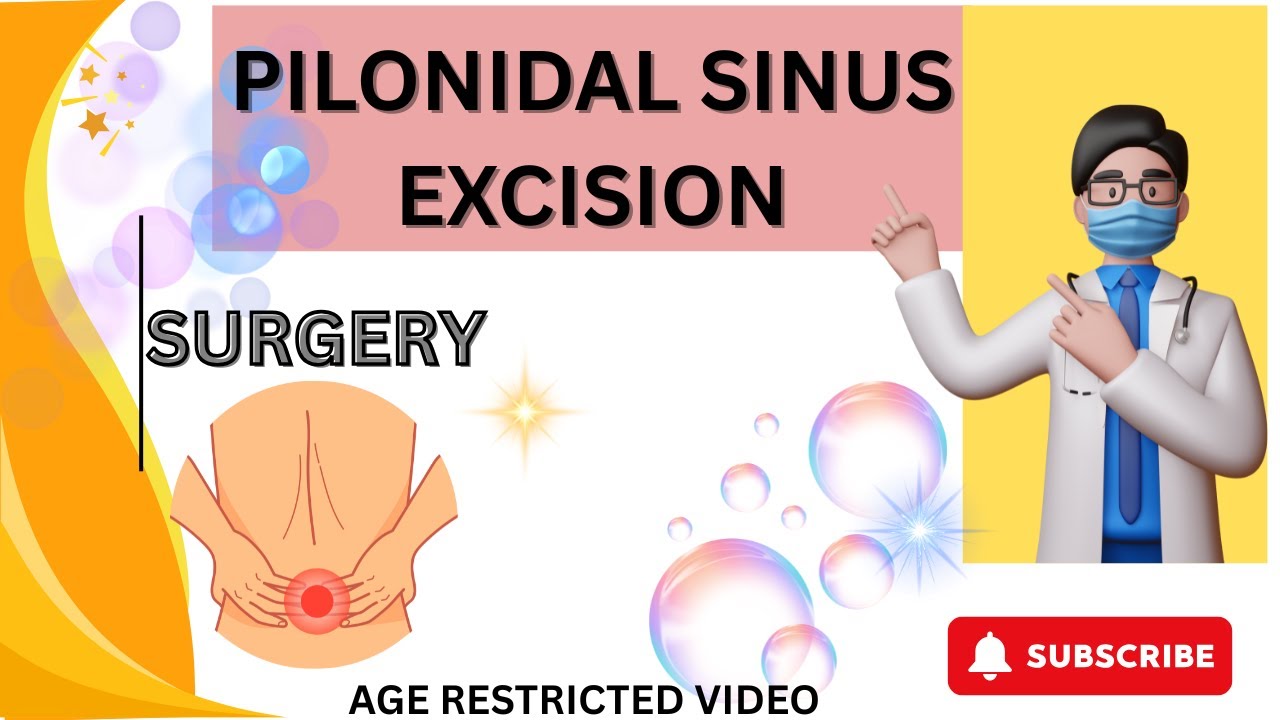 PILONIDAL SINUS EXCISION | SURGERY TO PILONIDAL ABSCESS - YouTube