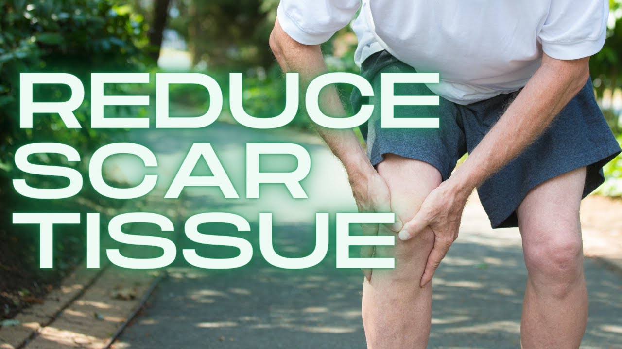 How To Get Rid Of Knee Scar Tissue NOW Naturally YouTube how-to-get-rid-of-knee-scar-tissue-now-naturally-youtube