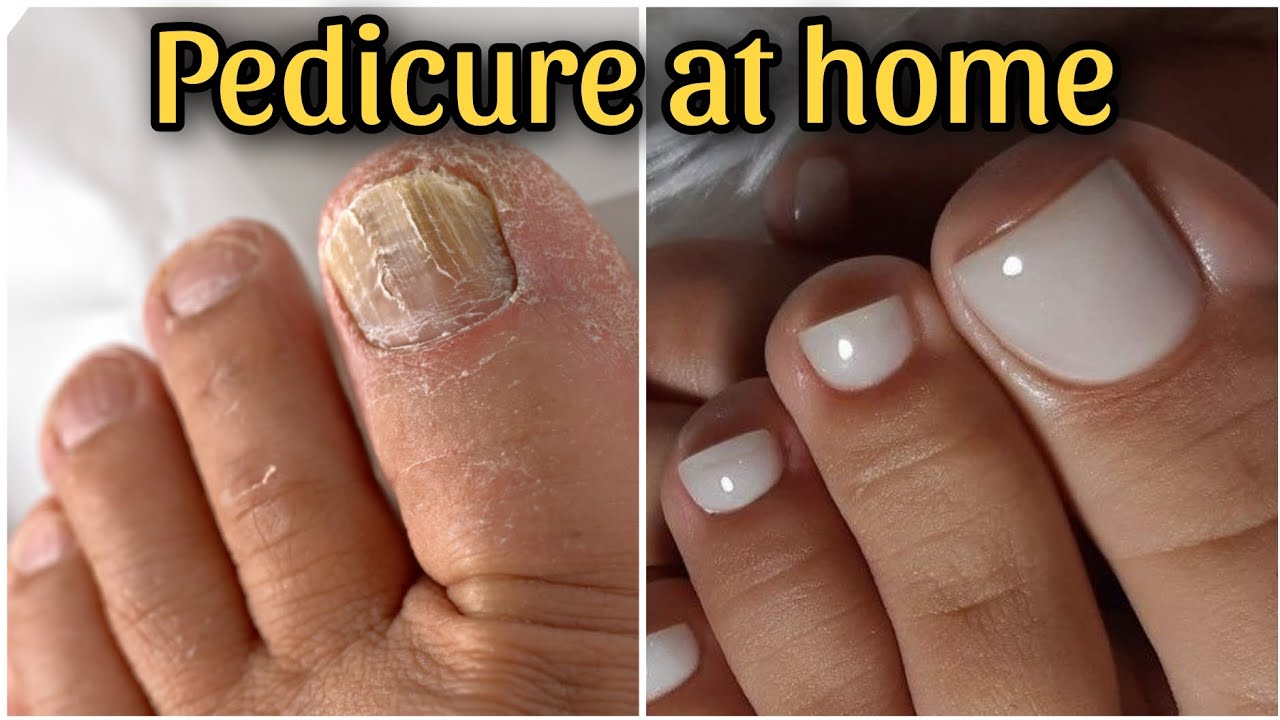 Pedicure at home || Transformation to dirty to clean nails || Easy step ...
