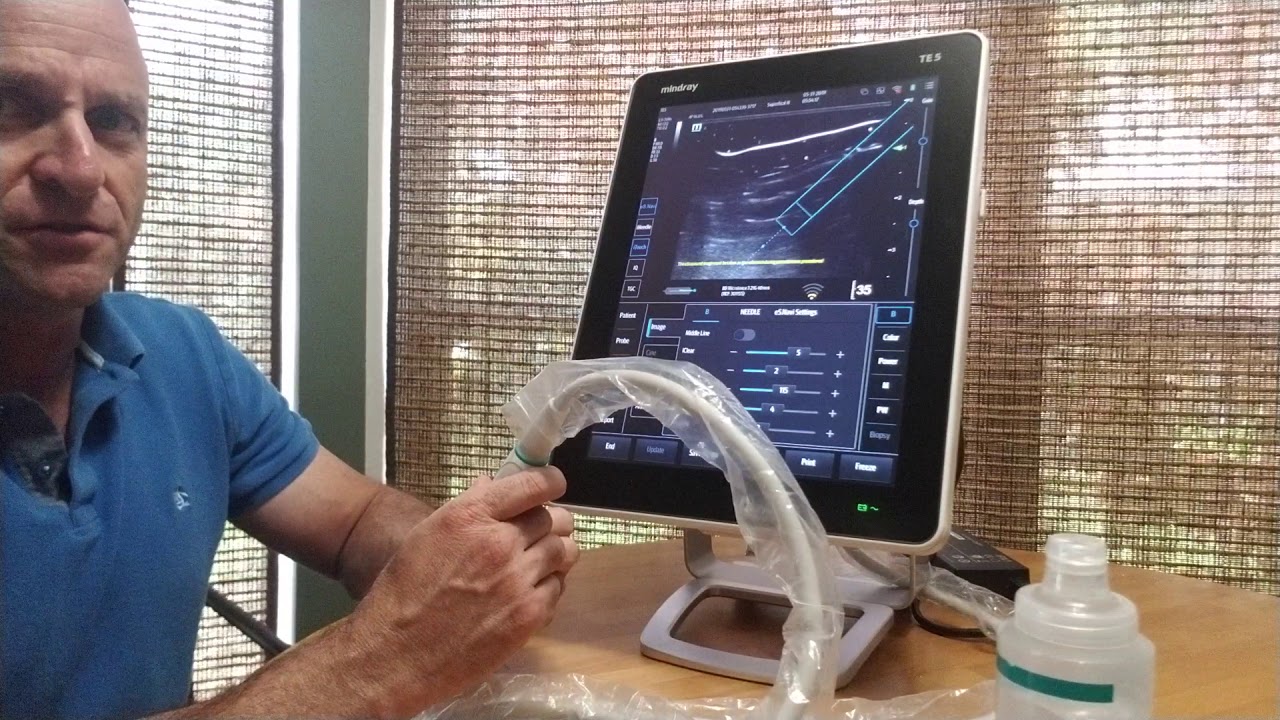 Magnetic Needle Mindray TE5 MSK Ultrasound - YouTube