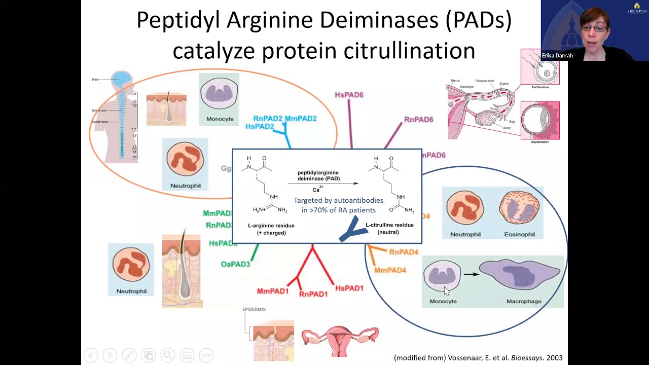 UW Rheumatology Grand Rounds - Dr. Erika Darrah, 4/7/2020 - YouTube
